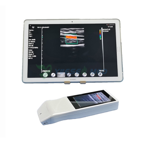 Wireless Color Doppler Probe Ultrasound | YSENMED