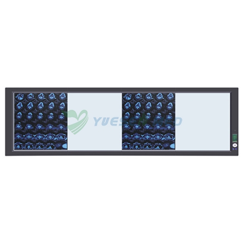 4 in 1 negatoscope wall mounting x-ray film viewer | Yuesen Med