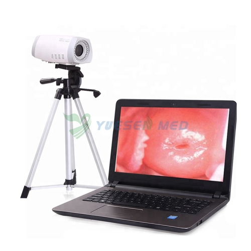 Gynecology examination digital optical colposcope portable video ...