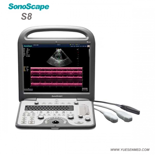 Sonoscape S8 - Sonoscape Portable Color Doppler Ultrasound S8 Price ...